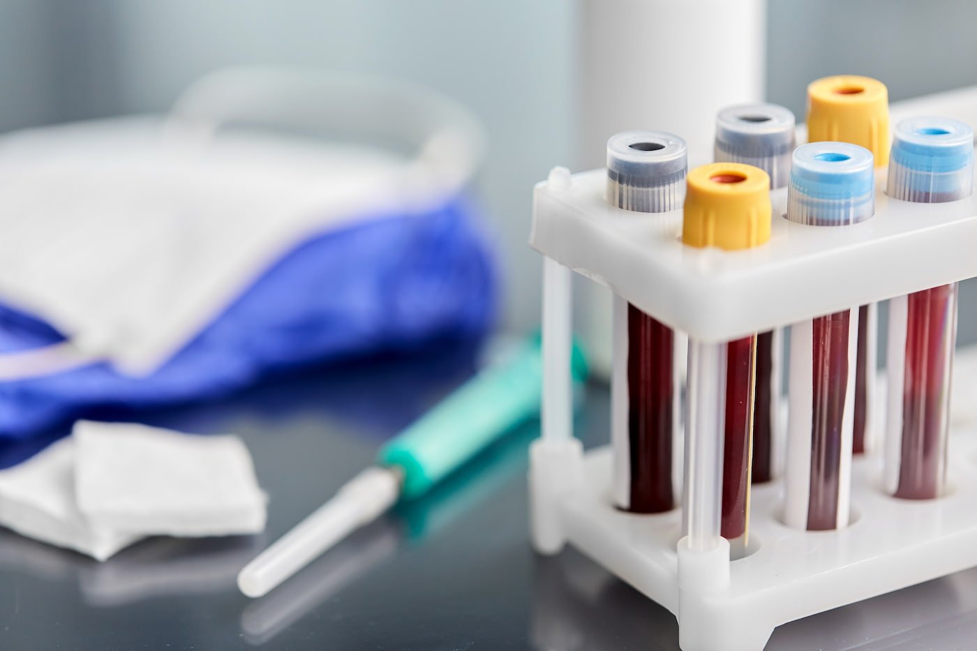 Blood Testing | Midlands Family Urgent Care